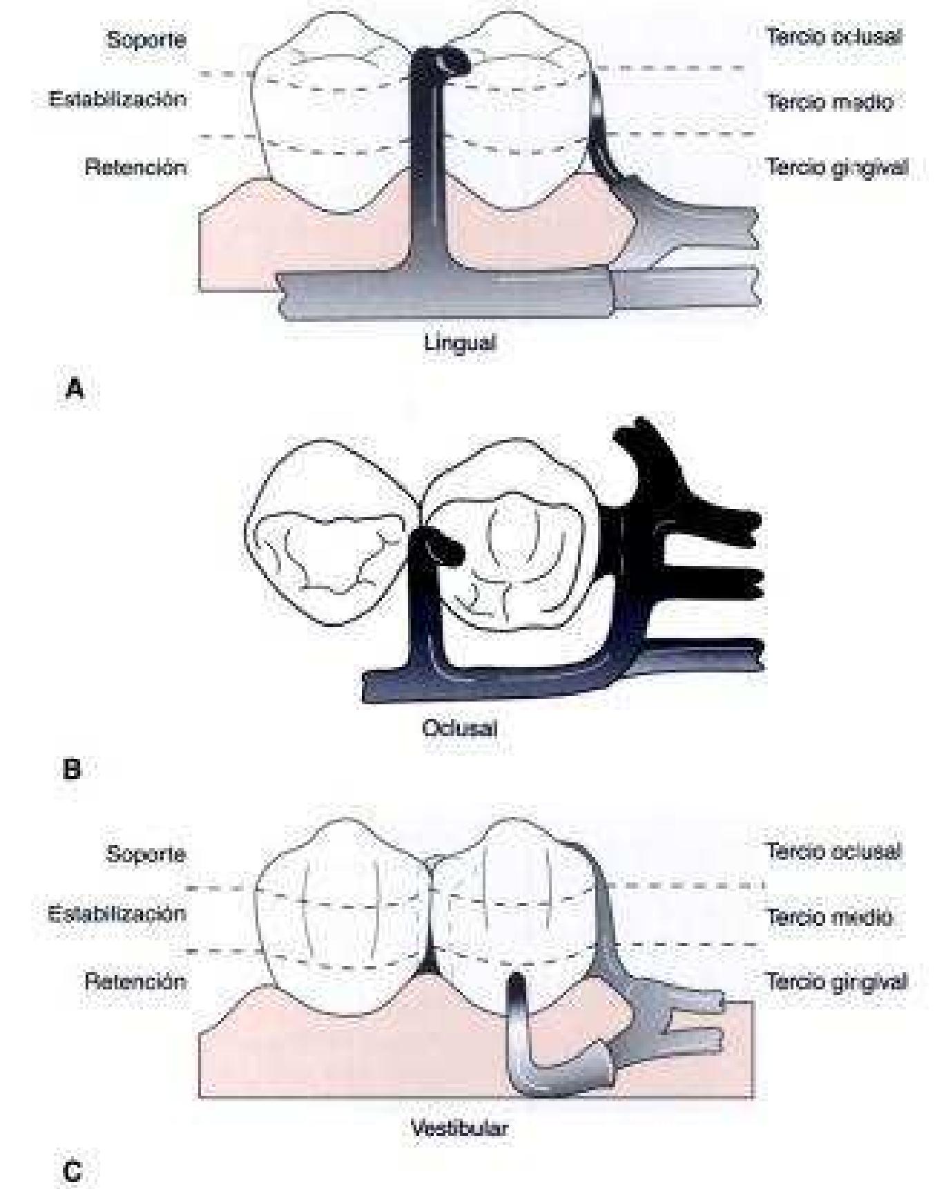 Ura 7-20) ganchoren bana encun premolar mandibular. a, el
