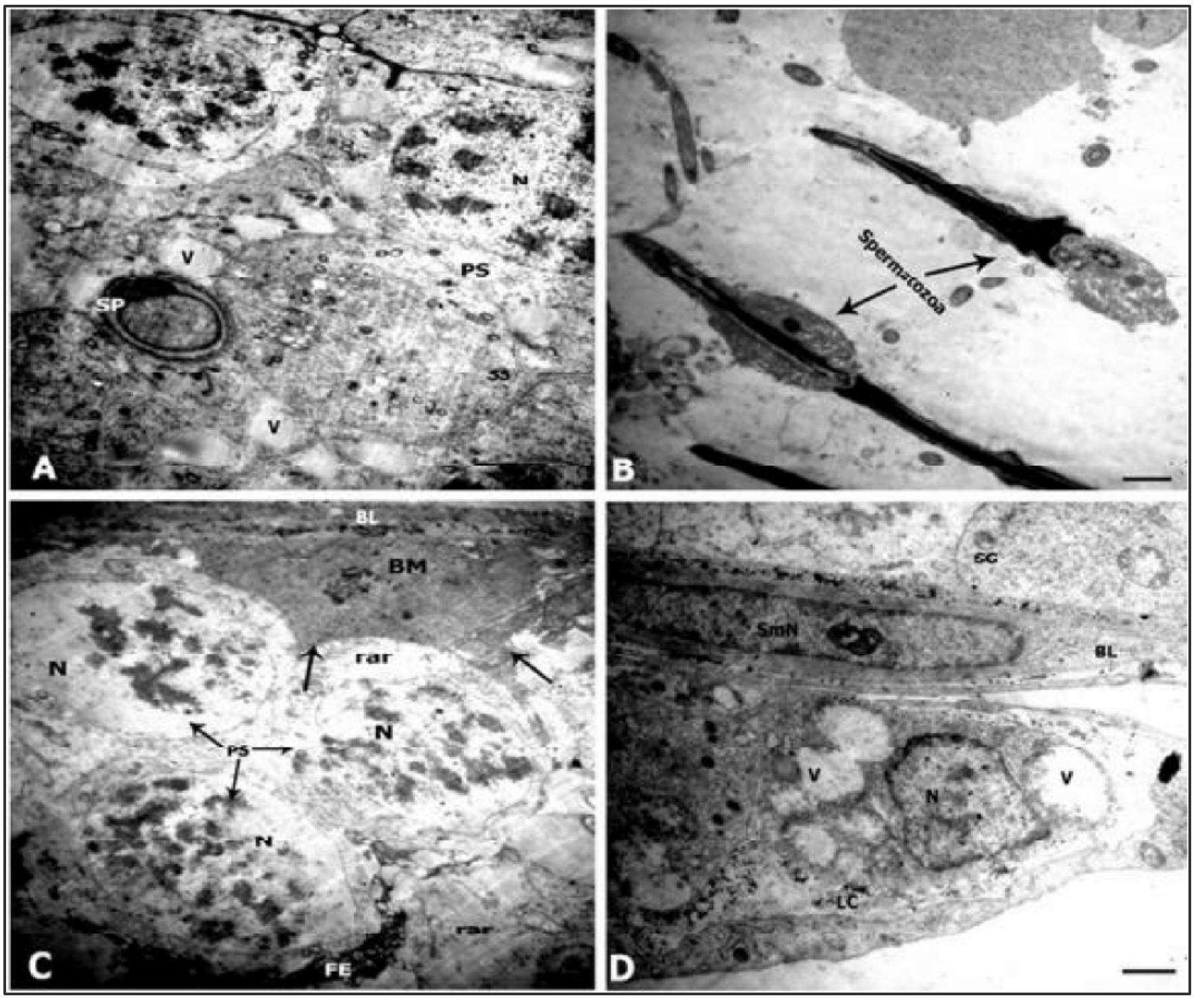Electron microscopy (tem) of rabbit testis from the treated