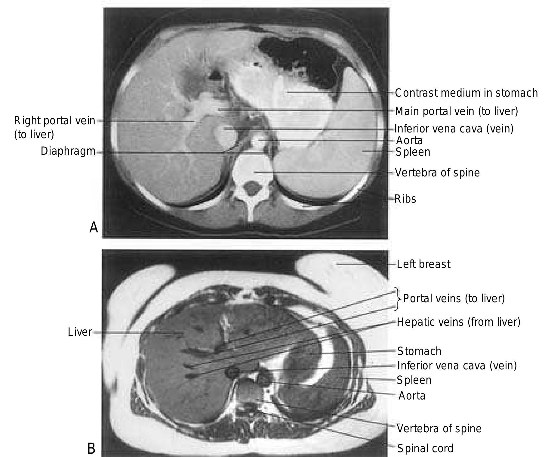 -10 cross-sections in imaging. images taken across the body