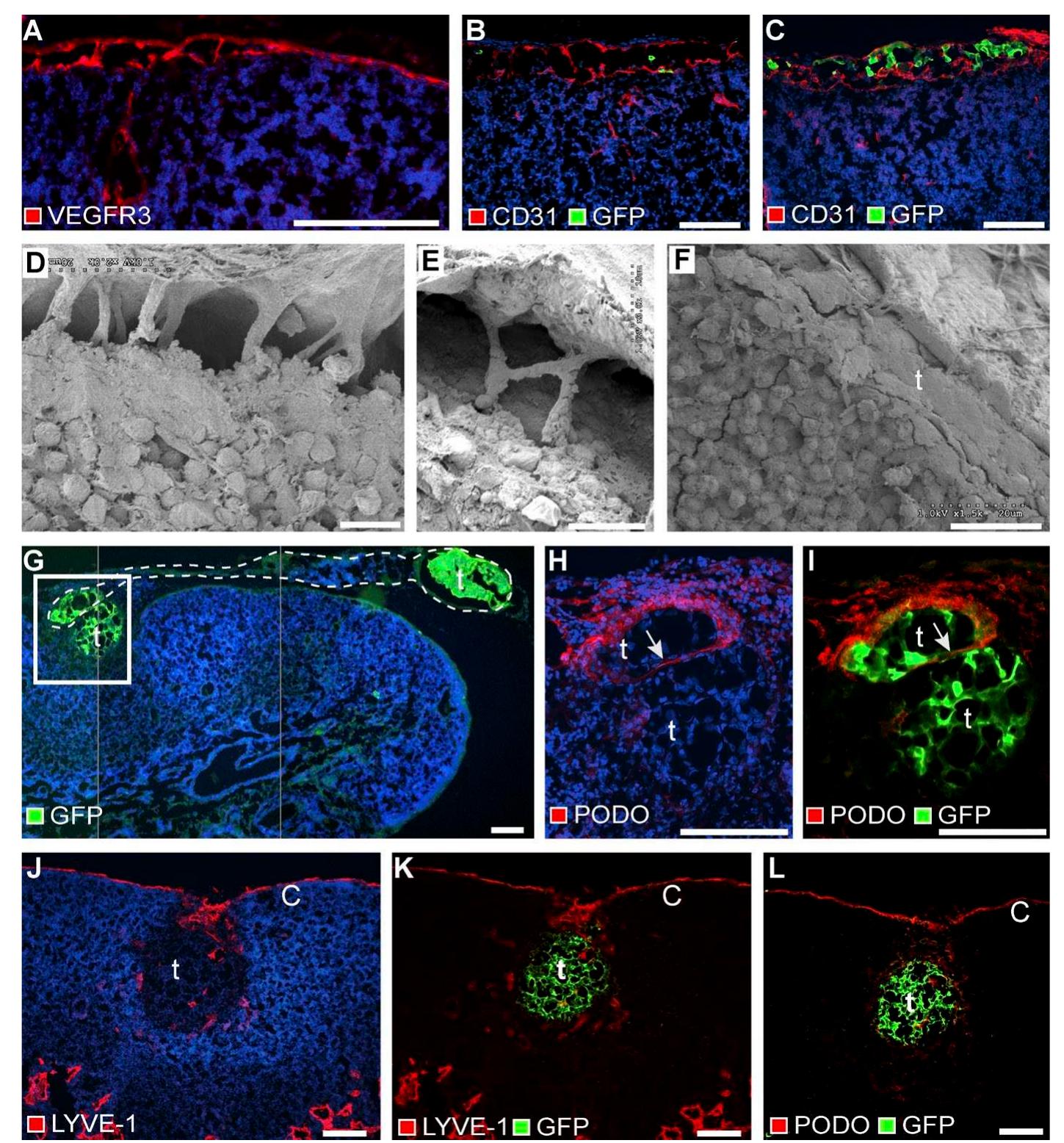 Steps of lymph node metastasis. (a-c) scs of the sentinel