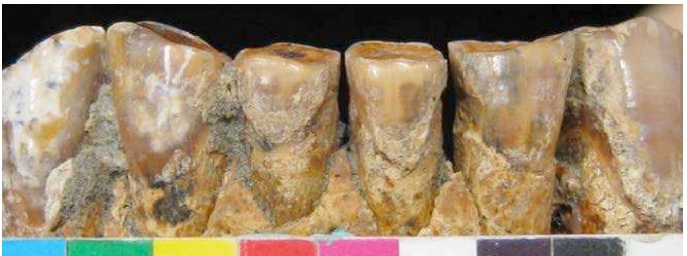 Nkle f5 b27, a middle-aged male. anterior mandibular teeth