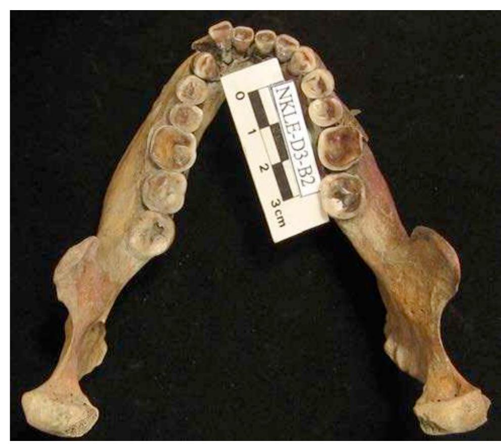 Figure 15 - from Dental Indicators of Health in Early