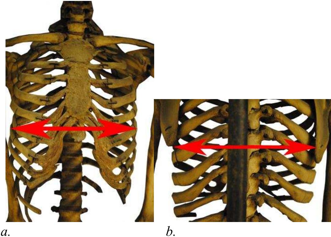 (PDF) Effects of Long Term Corseting on the Female Skeleton: A ...