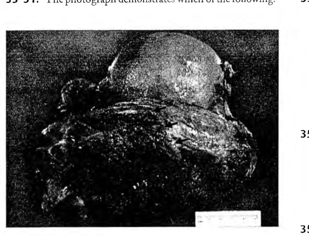 Reproduced, with permission, from cunningham fg, leveno kj,