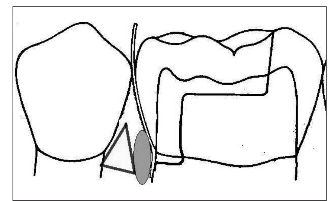 B. schematic diagram showing a cross-section of the