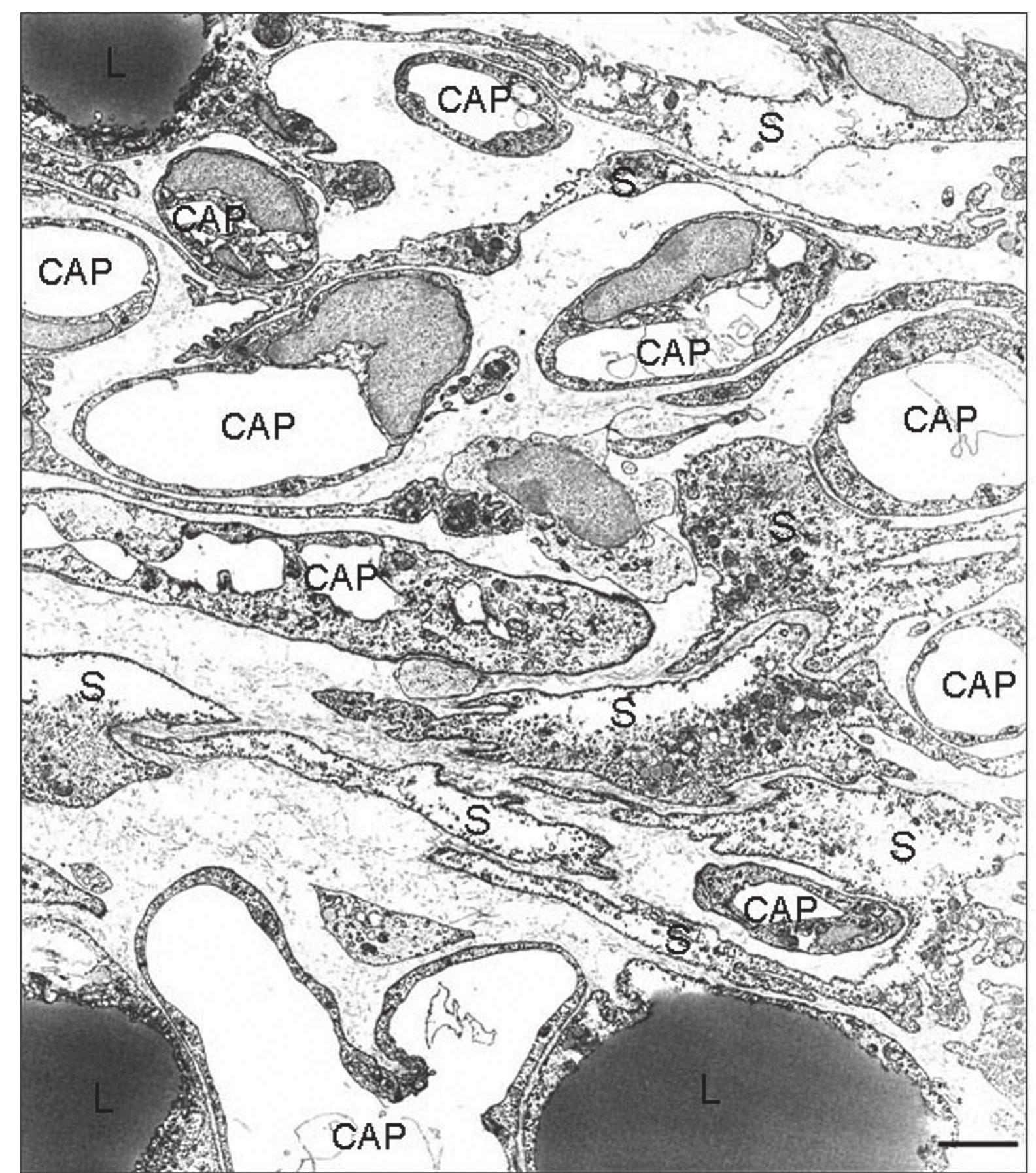 Electron microscopy of white adipose tissue of fasted mouse.