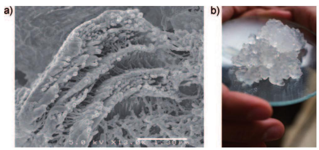 A) electron microscopy (magnification: 13000x; scale bar: