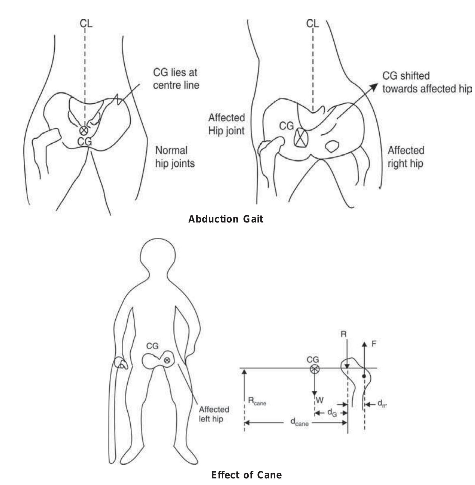 Mechanics of the knee the femur and the tibia. these