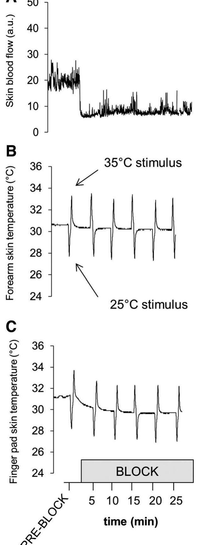 Figure 4 - from Why wet feels wet? A neurophysiological