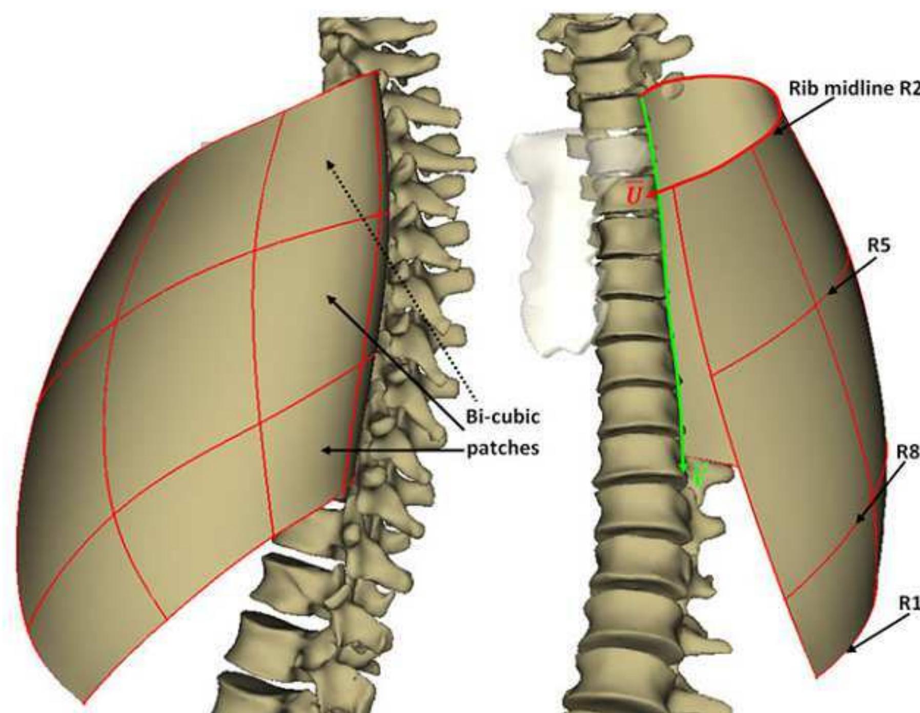 Figure 4 - 3D reconstruction of rib cage geometry from