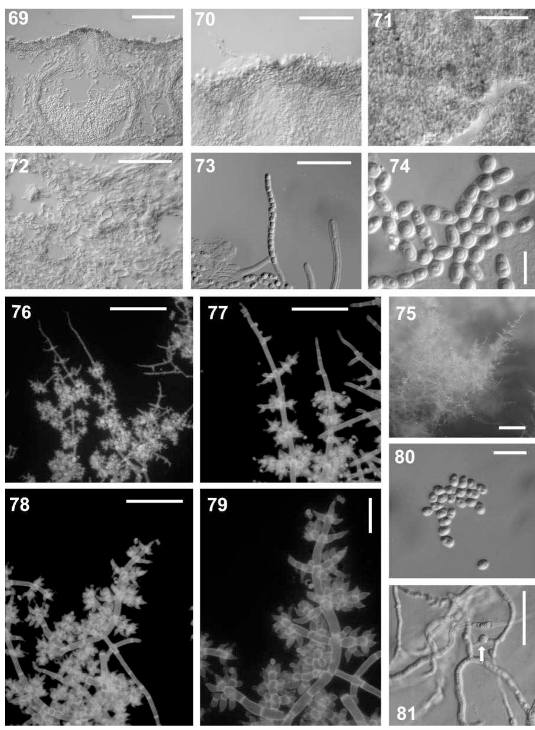 Fics. 69-81. hypocrea stellata and its trichoderma anamorph.