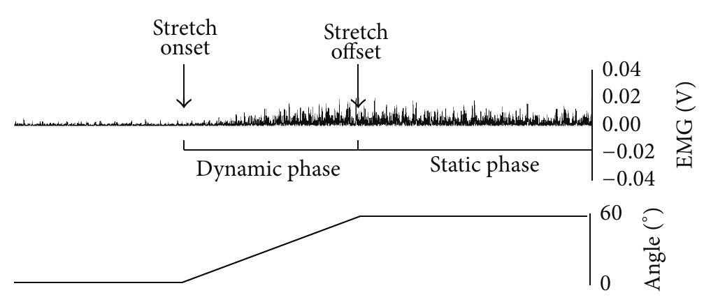 Figure 1 - Pathophysiology of Spasticity: Implications for