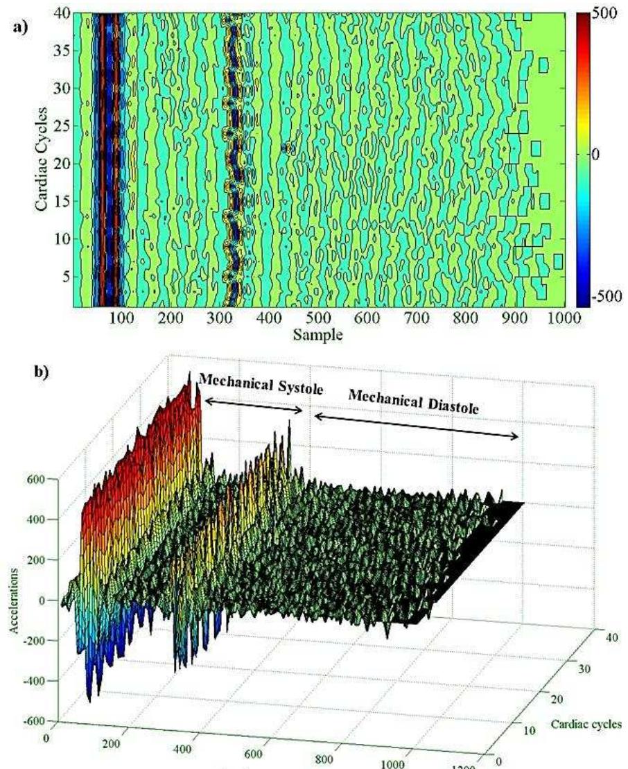 Color map of the cardiac quiescent phases (a) and mechanical