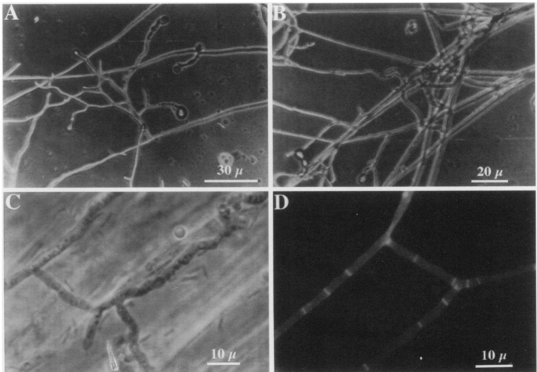 Fic. 2. morphology of p. indica hyphae. a. on mm agar; b. on