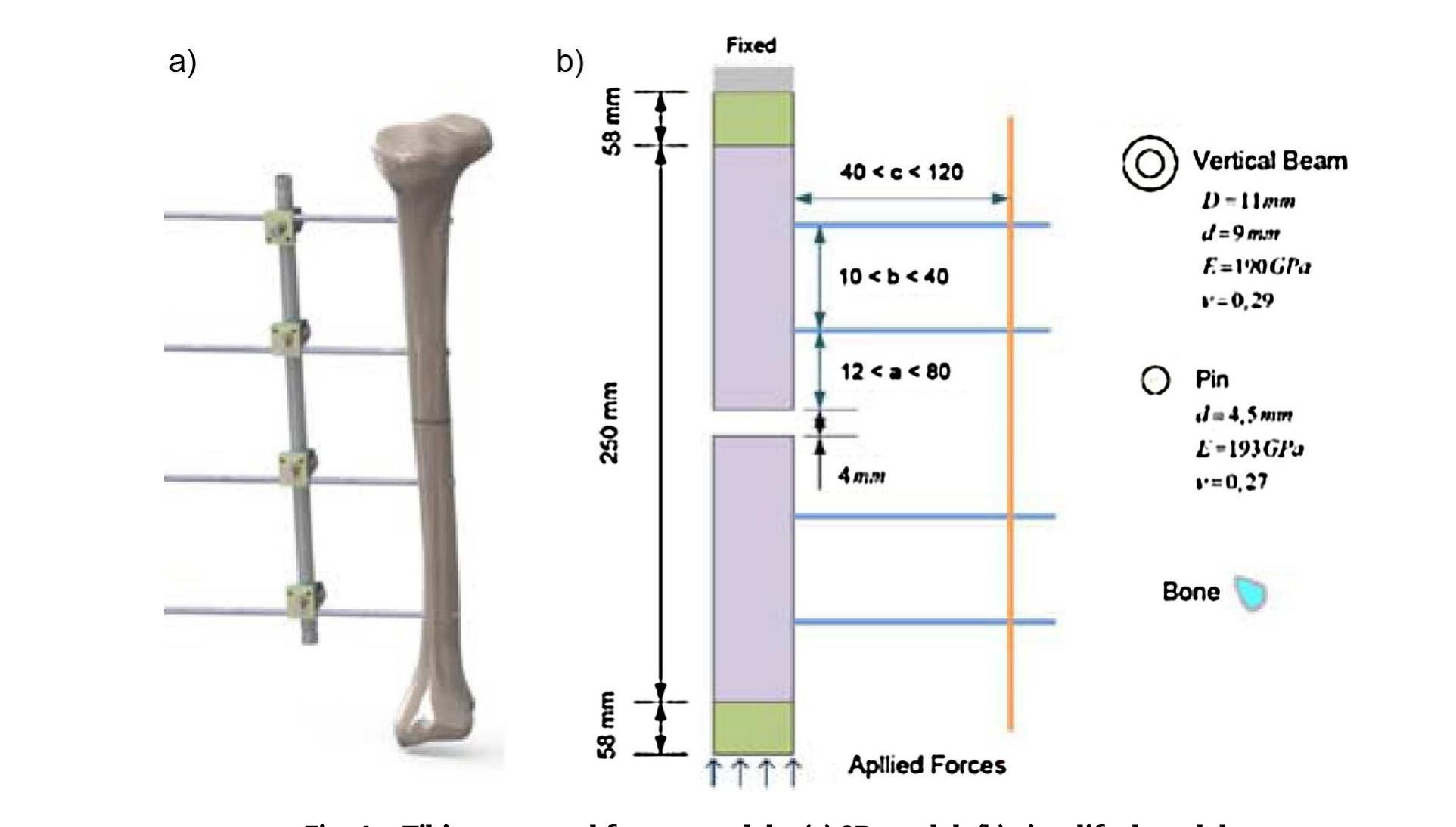 Figure 4 - External fixator configurations in tibia
