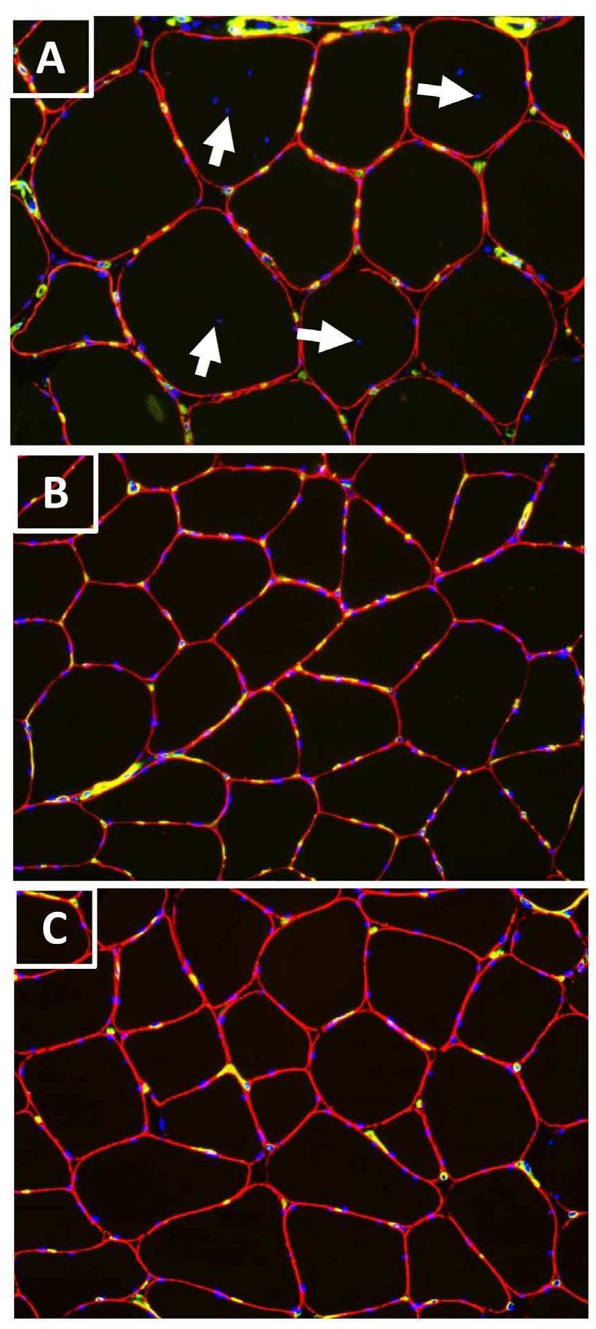 Figure 1 - from Effects of Long Term Supplementation of