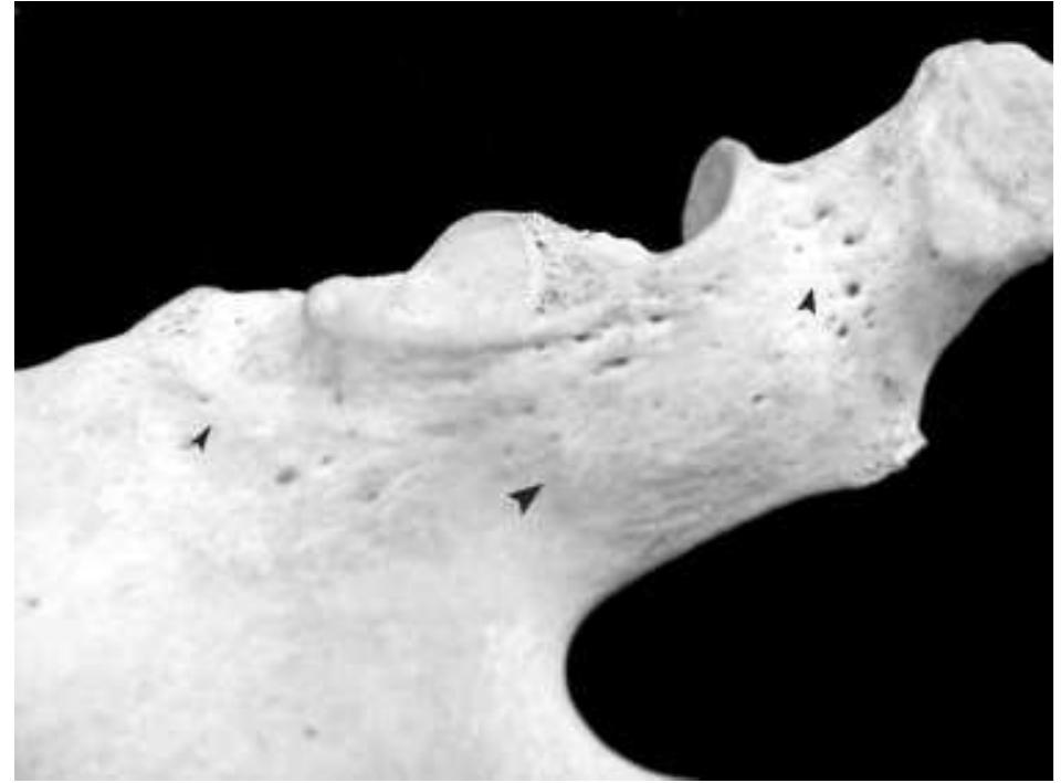 Figure 14 - Using the Acetabulum to Estimate Age at Death of