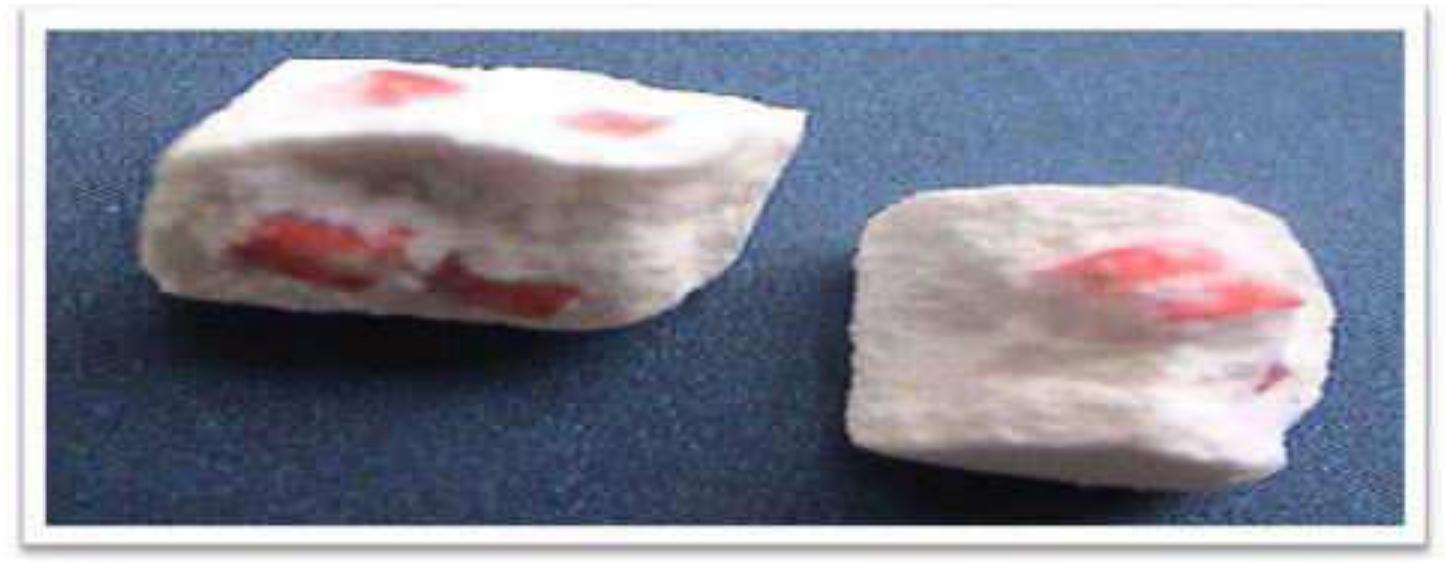 Fracture equatorial showing surfaces of the compressed