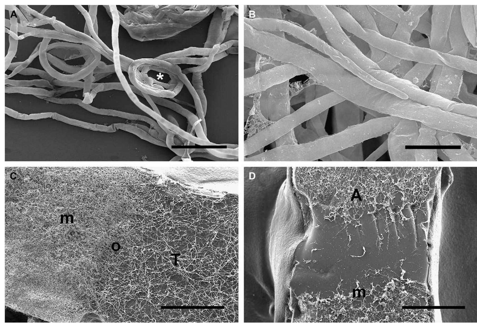 - sem micrographs of mycelia of the test-species tuber
