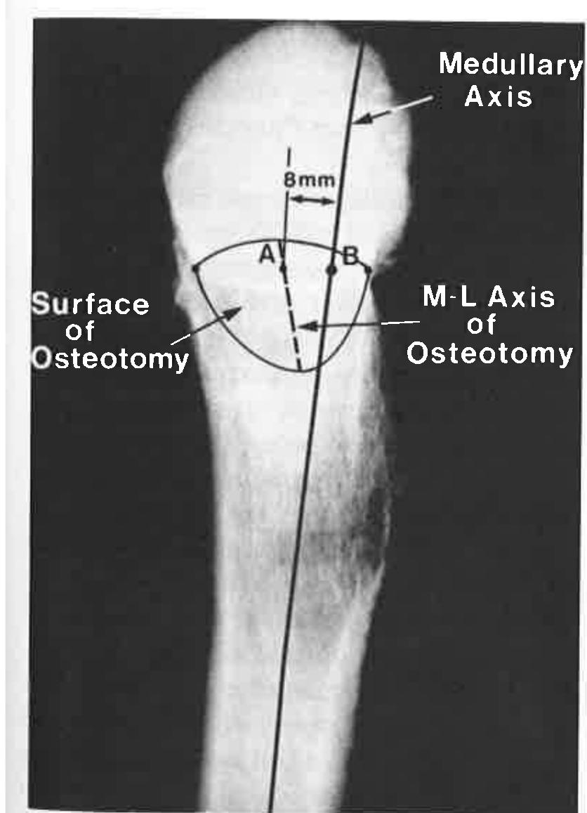 Fic. 6, a lateral roentgenogram of the proximal femur with