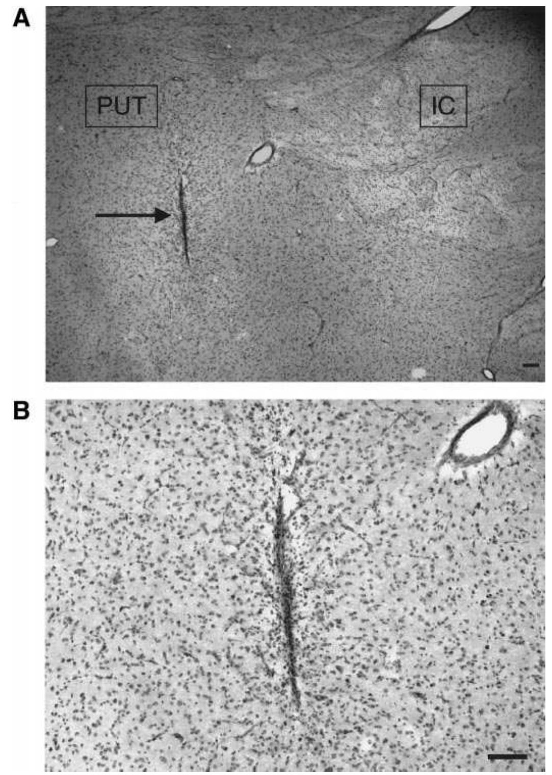Hematoxylin and eosin staining of the putamen following ced