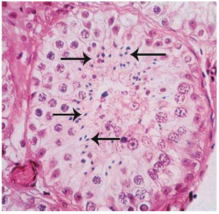 12 testicular histology of a 5.2-year old boy with an acti-