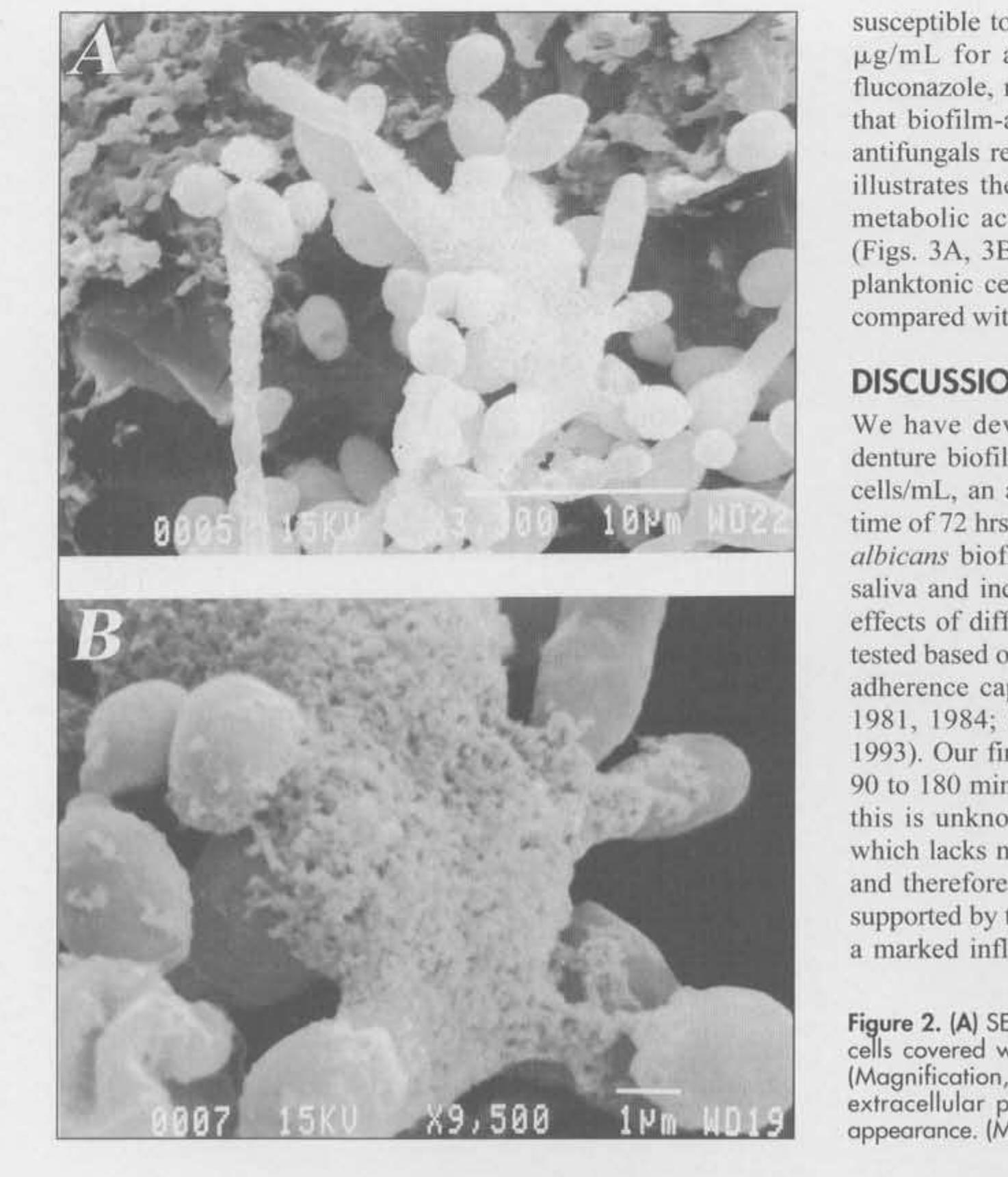 Figure 2 - Antifungal Resistance of Candidal Biofilms Formed