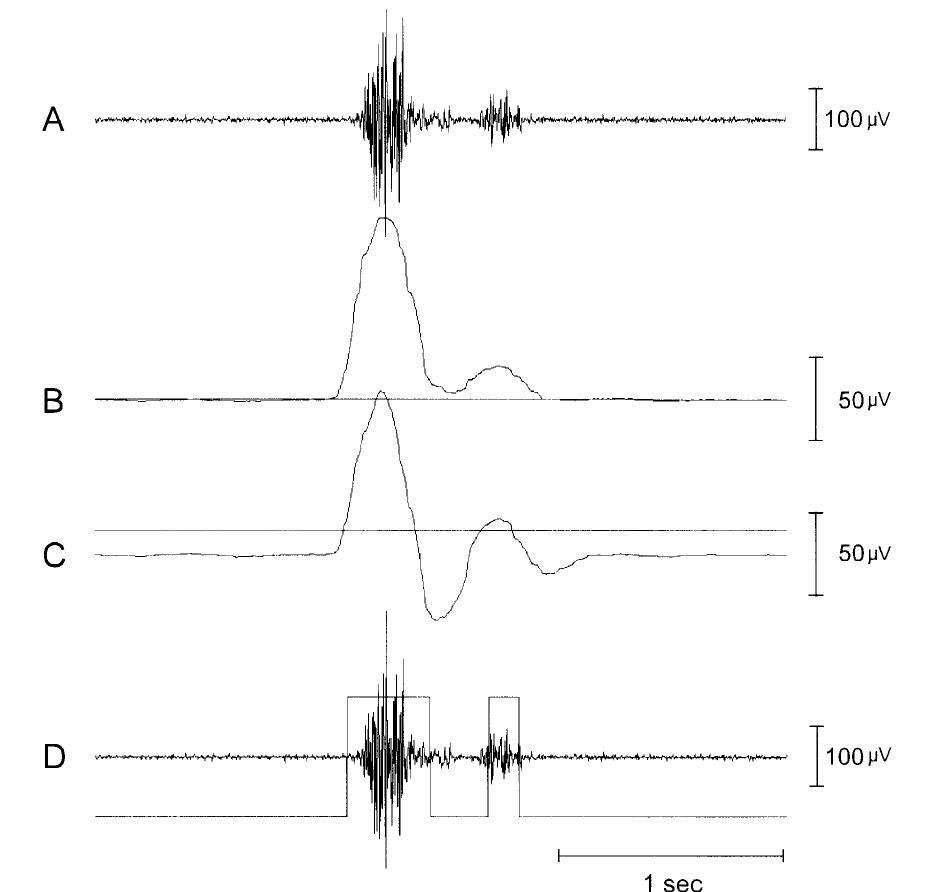 A-d representation of the emg analysis procedure. a raw
