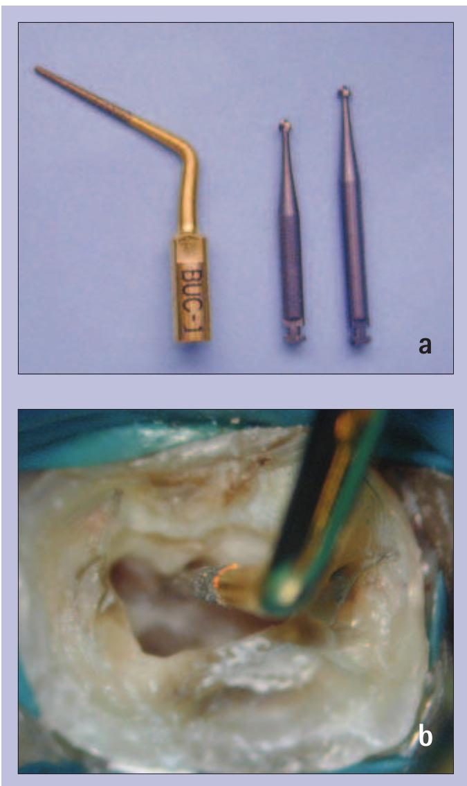 (PDF) A practical guide to endodontic access cavity preparation in ...