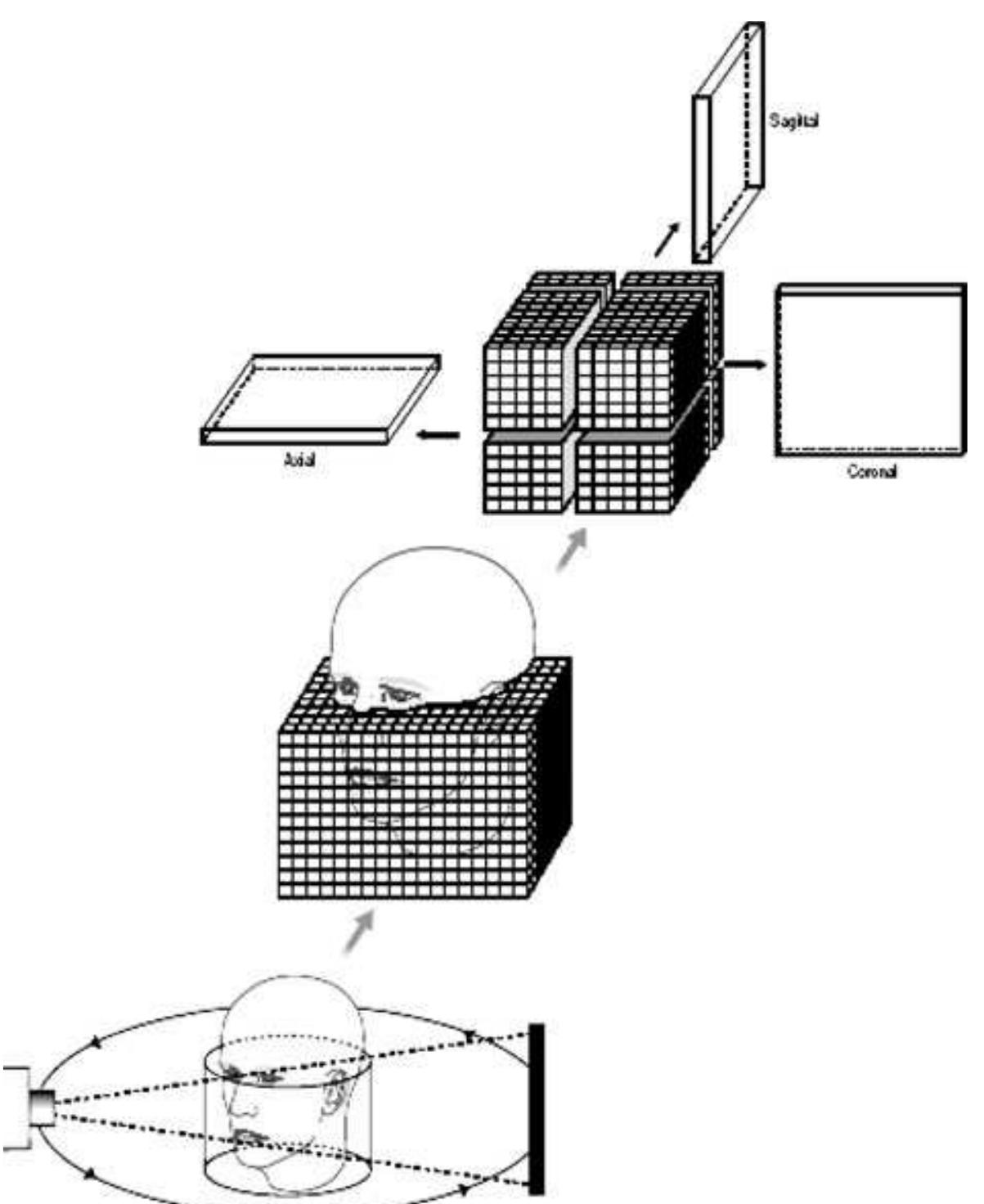 Diagram showing the basic concept of cbct. a cone-shaped