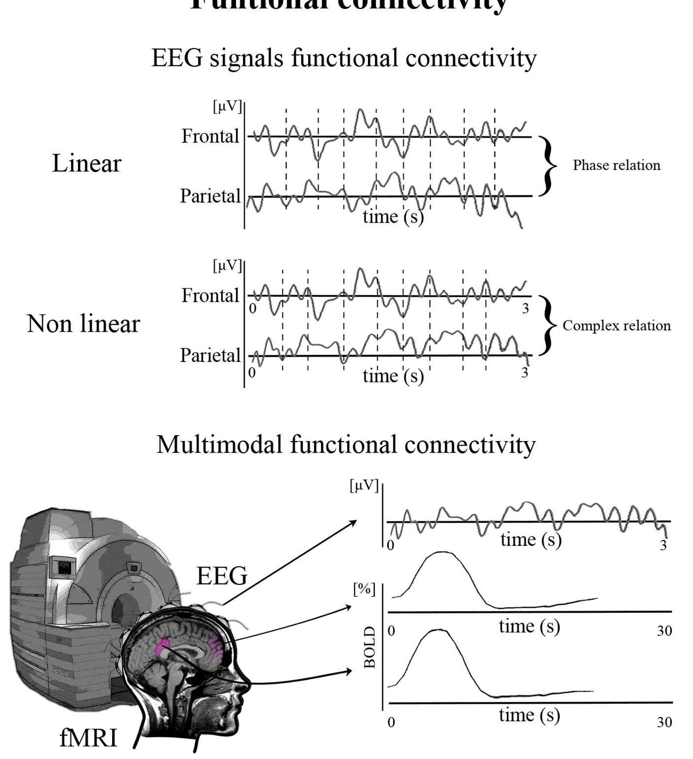 Top: sketch of main models of functional brain connectivity
