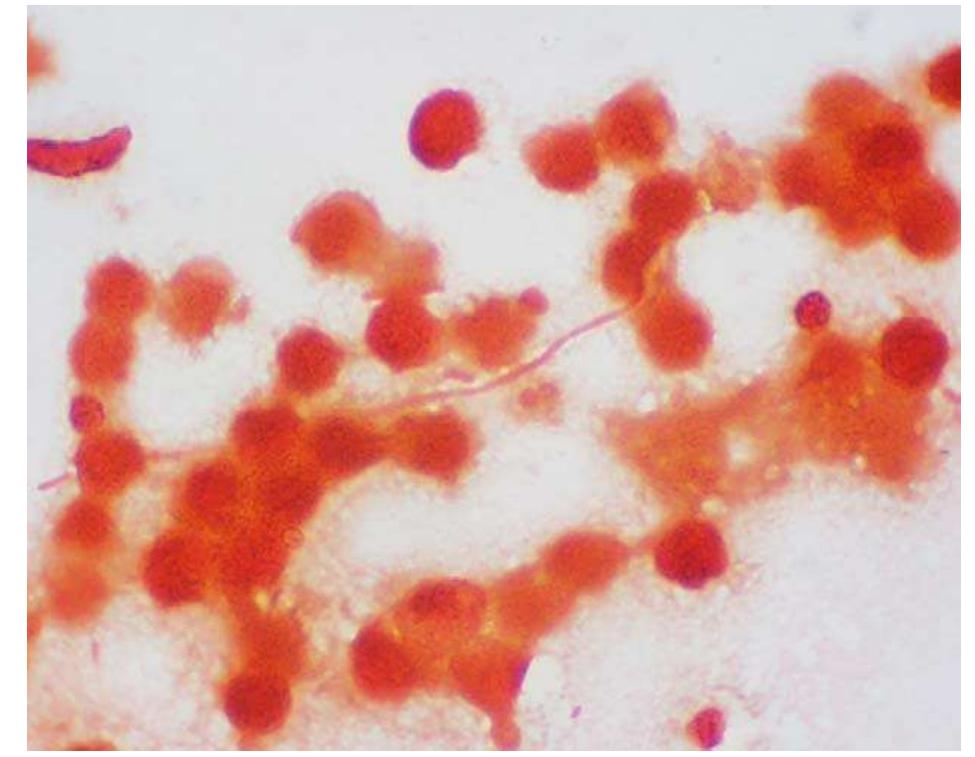 Figure 3 - from Feline cholecystitis and acute neutrophilic