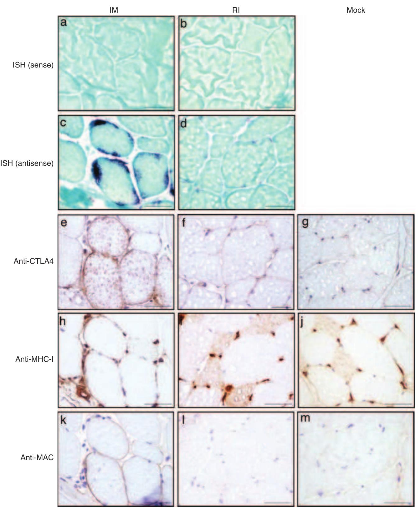 /n situ hybridization and immunostaining of