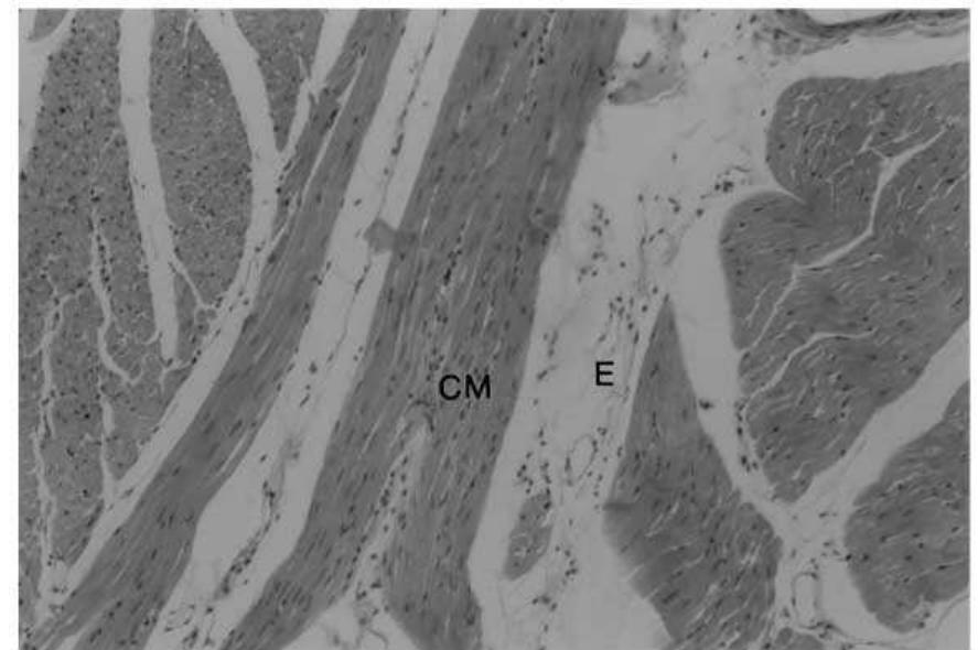 Transverse section of the cardiac muscle in control group