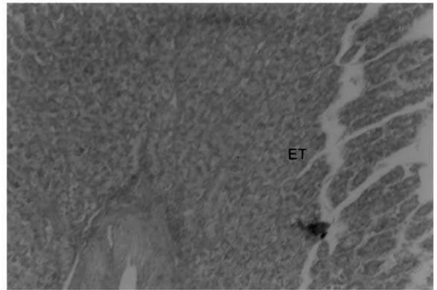 Transverse section of the stomach in the group, which is