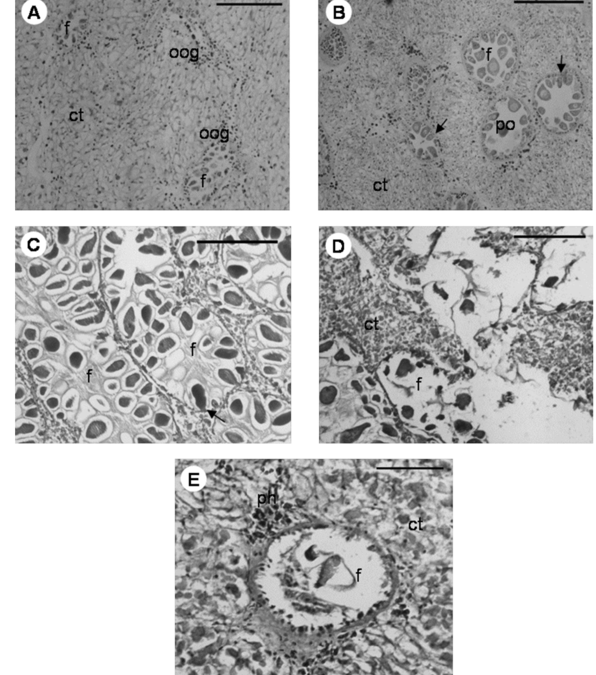 Photomicrographs of cross sections of female gonadal tissue