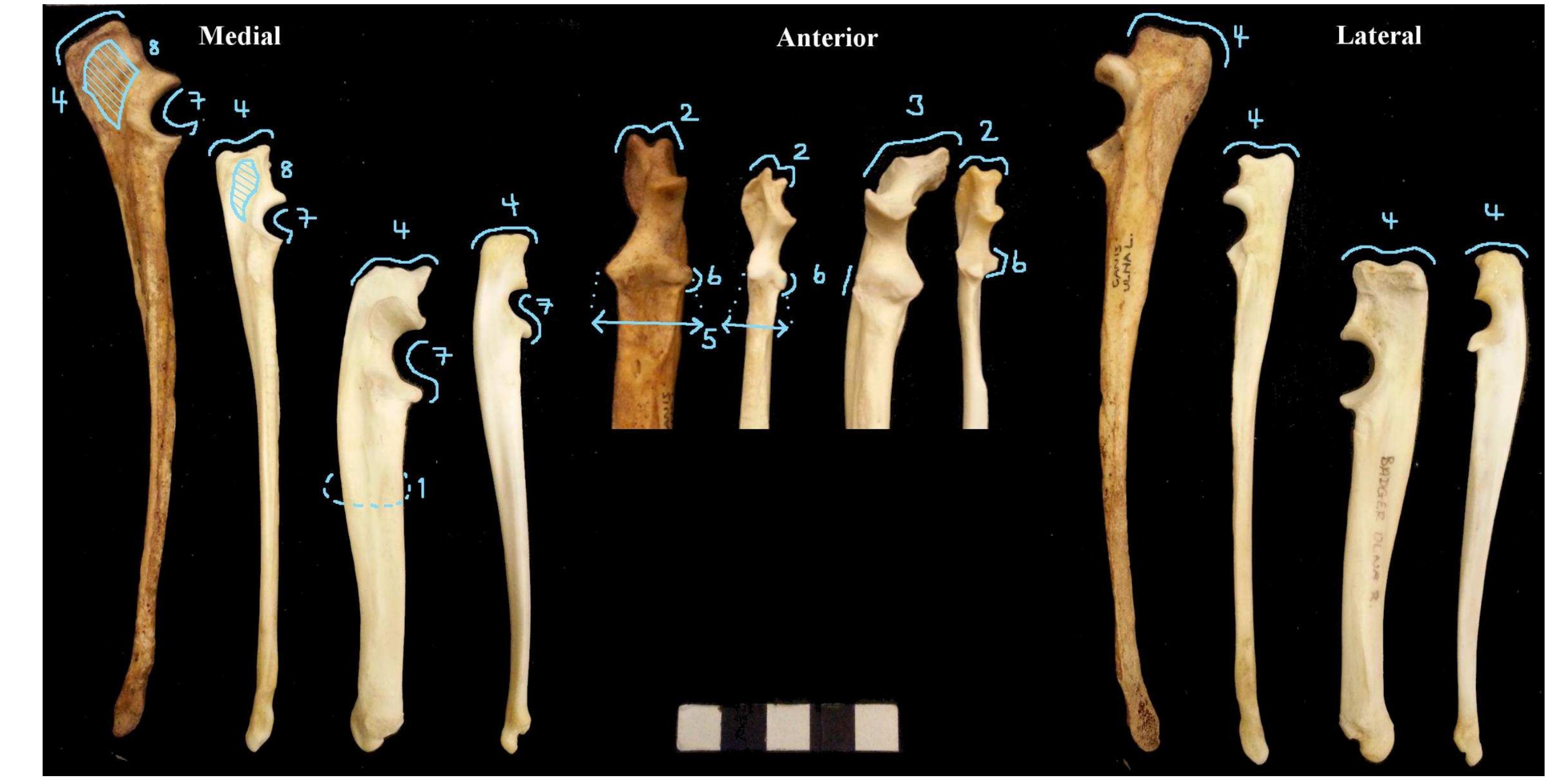 Ulna, medial, anterior and lateral views.