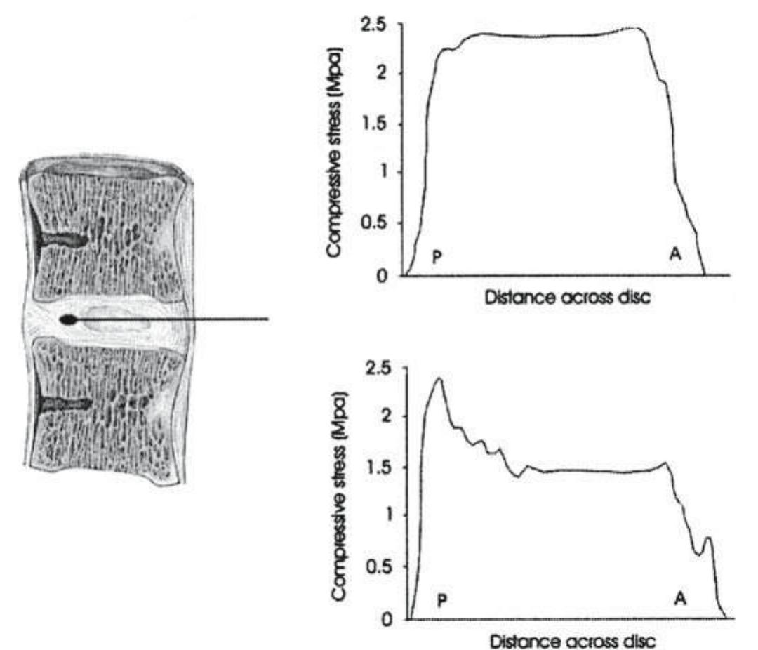 Typical stress profiles for grade-1 disc (top) and for a