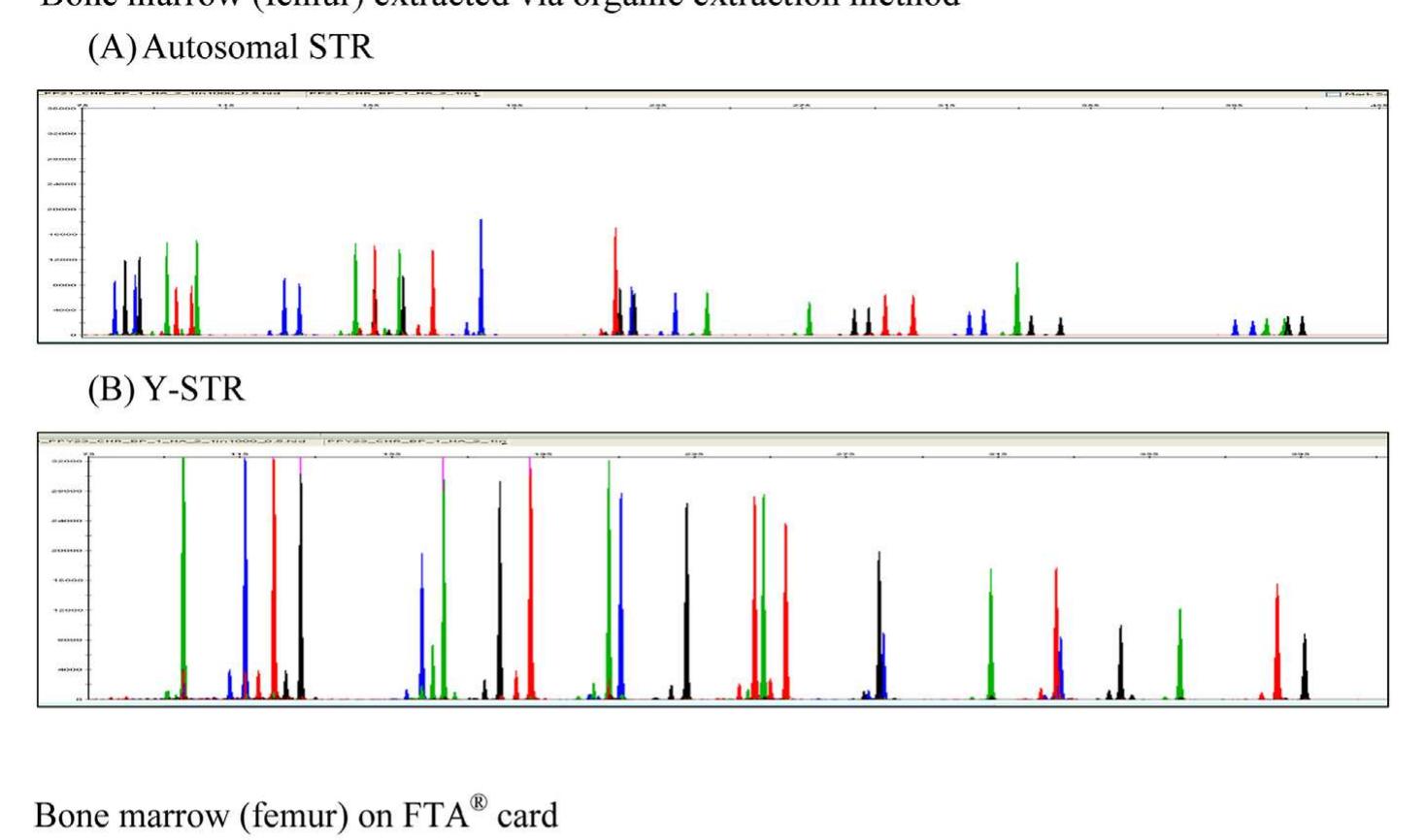 Figure 6 - Comparing different post mortem human samples as