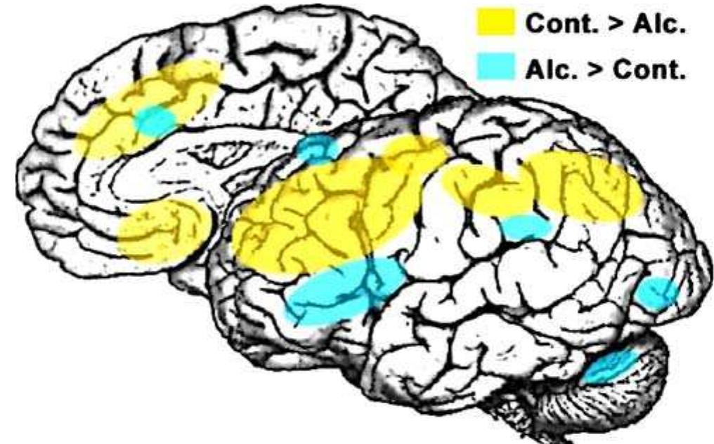 A schematic summary and conceptual model of the brain
