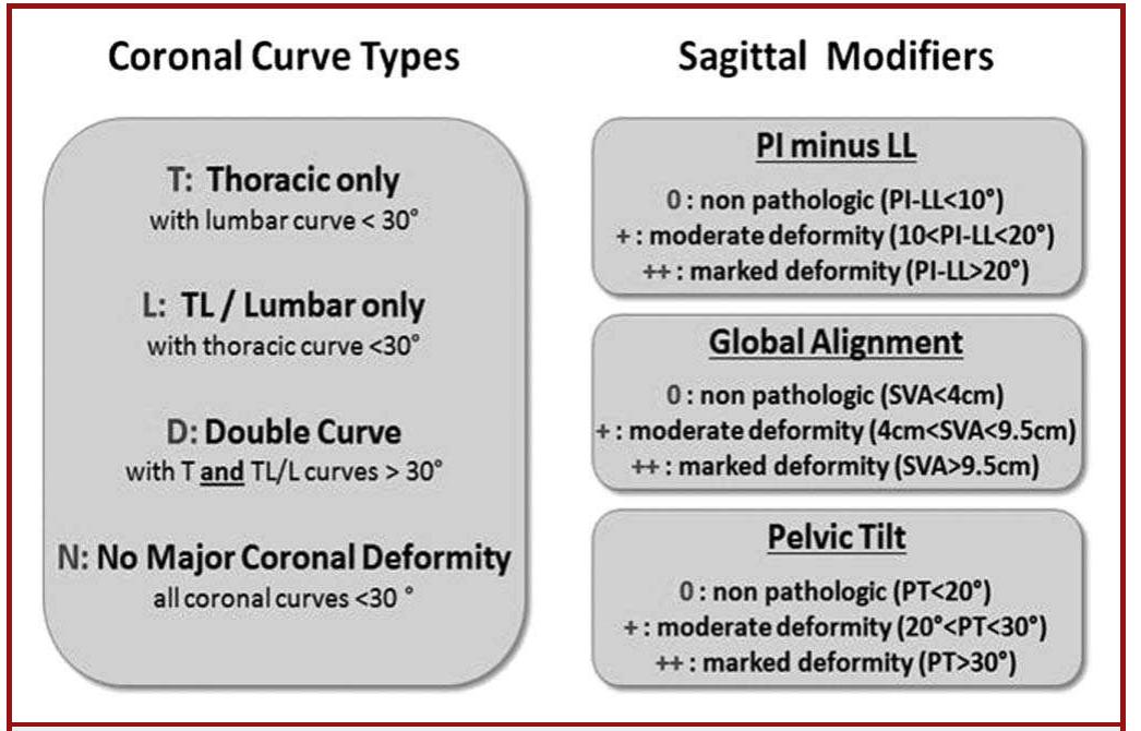 Srs-schwab classification of adult spinal deformity."°