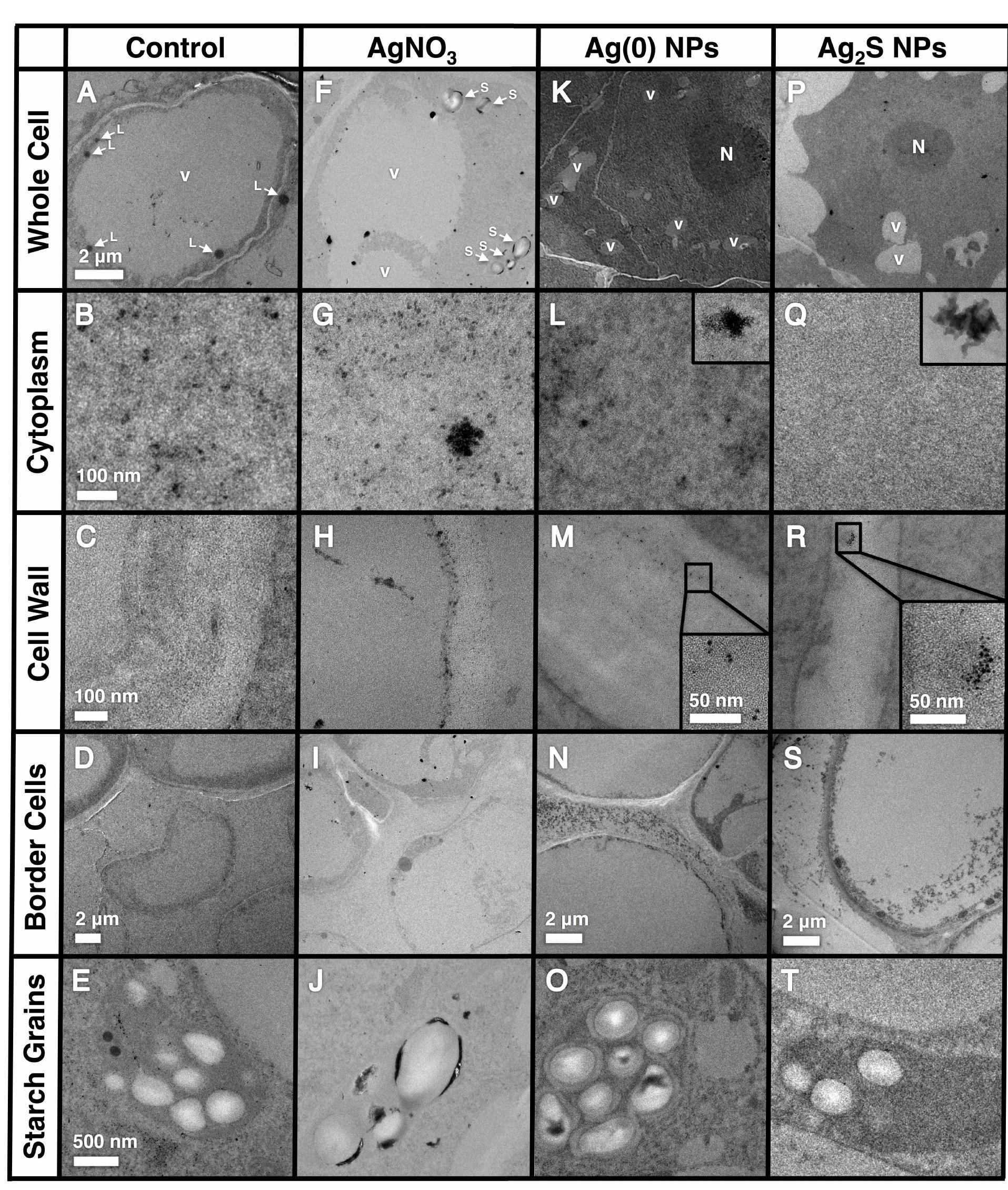 Transmission electron microscopic images of control and
