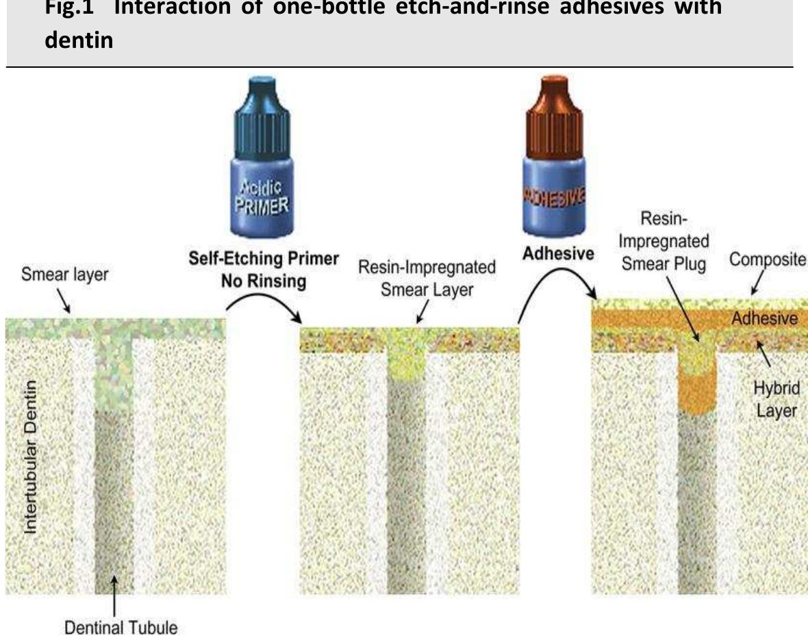 Interaction of two-bottle self-etch adhesives with dentin.