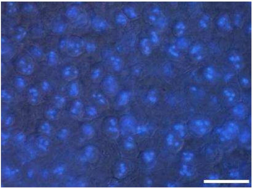 Nuclear staining of basidia in immature fruiting bodies of