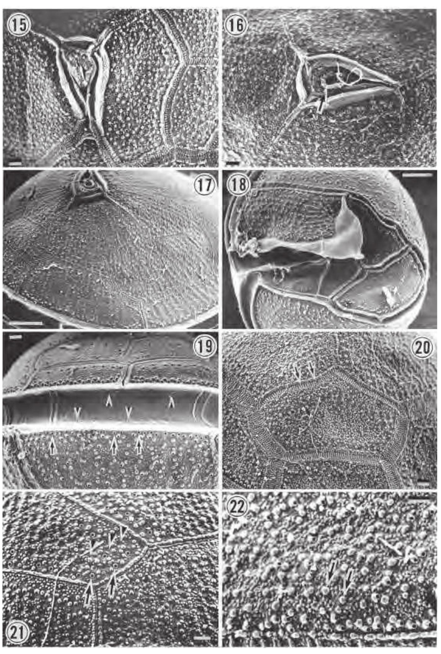 The apical pore complex (consisting of the apical pore p,
