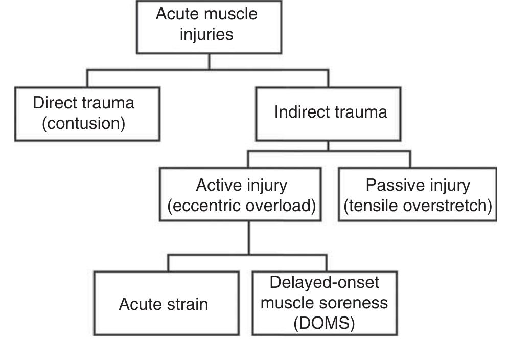 Classification of acute muscular injuries. adapted with