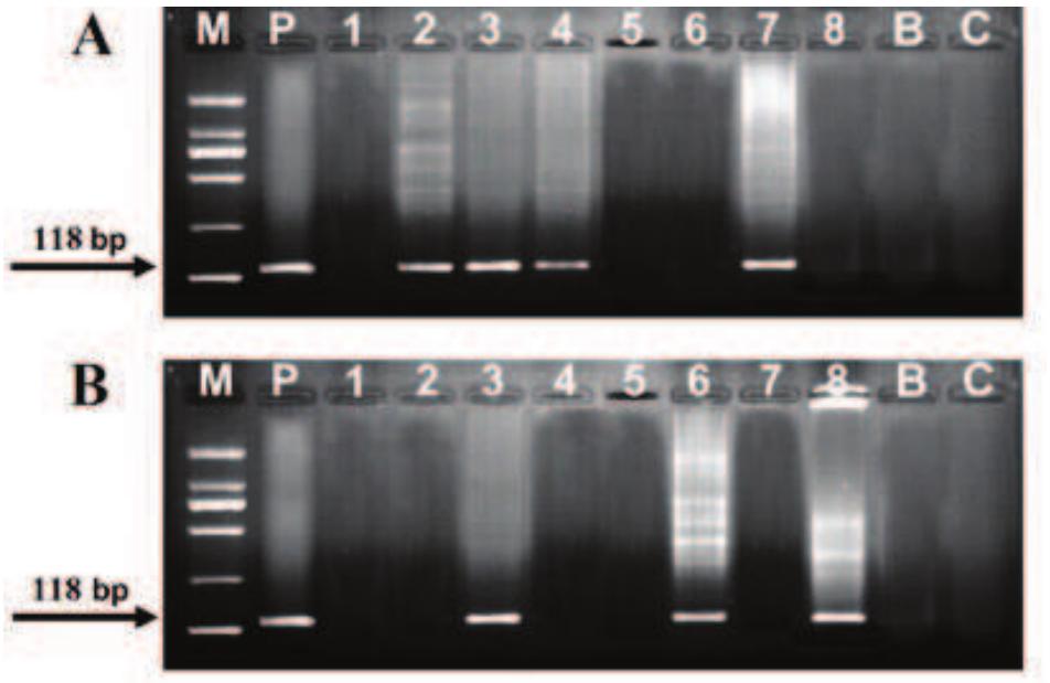 Agarose gel electrophoresis of pcr products of dna extracted