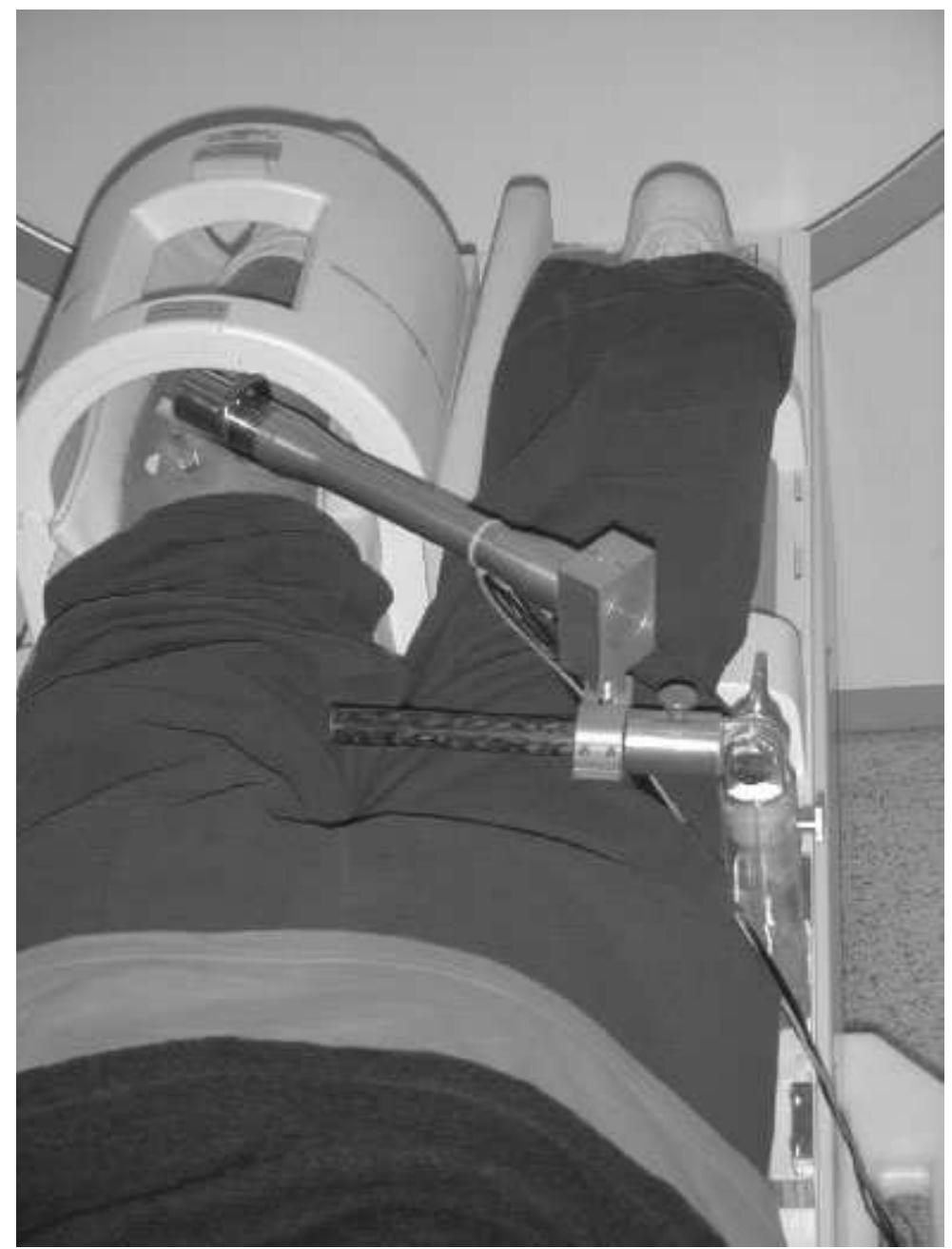 Setup using a transmit—receive extremity coil for