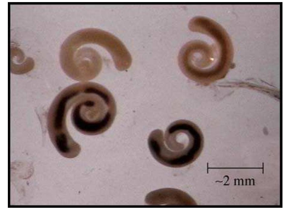 Photomicrograph of pentastomes showing typical shape. figure