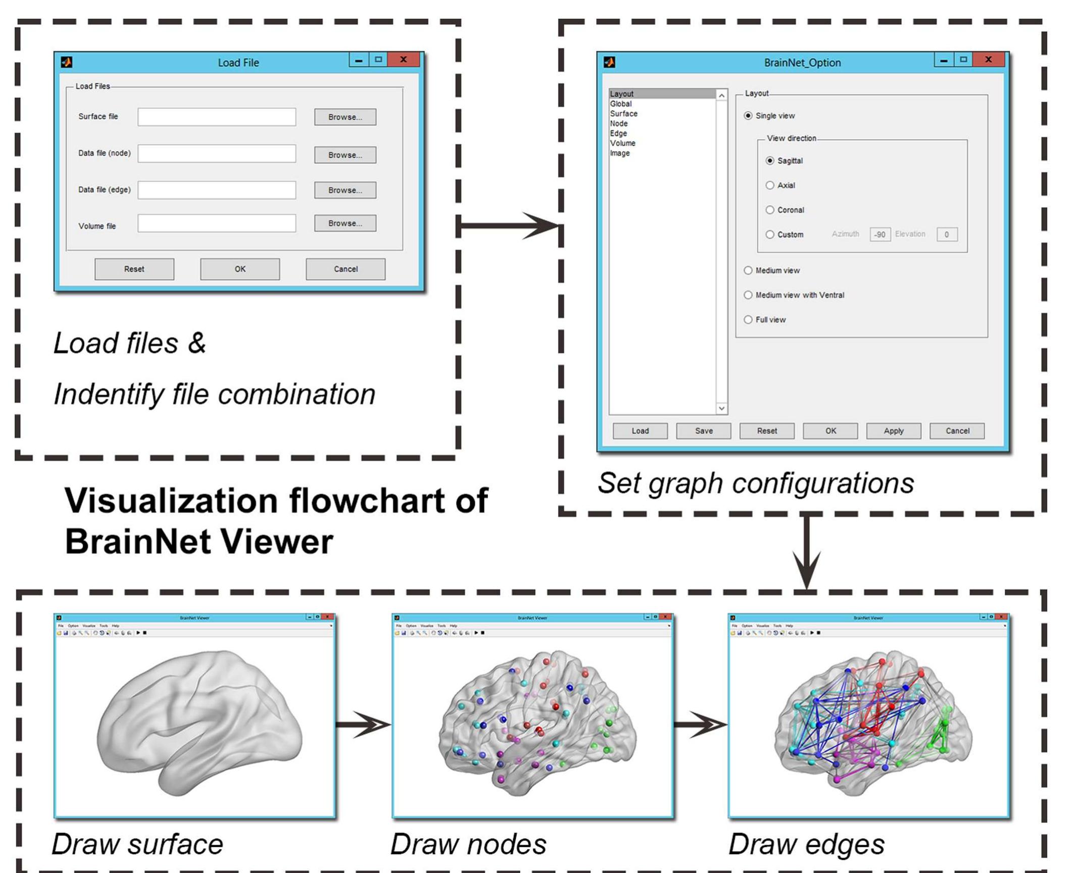 A flowchart for visualization of brainnet viewer. first, the